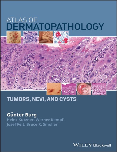 Ebook – Atlas of dermatopathology tumors, nevi, and cysts (PDF Instant ...