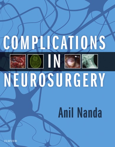 Ebook – Complications in Neurosurgery (PDF Instant Download) – Manybook ...